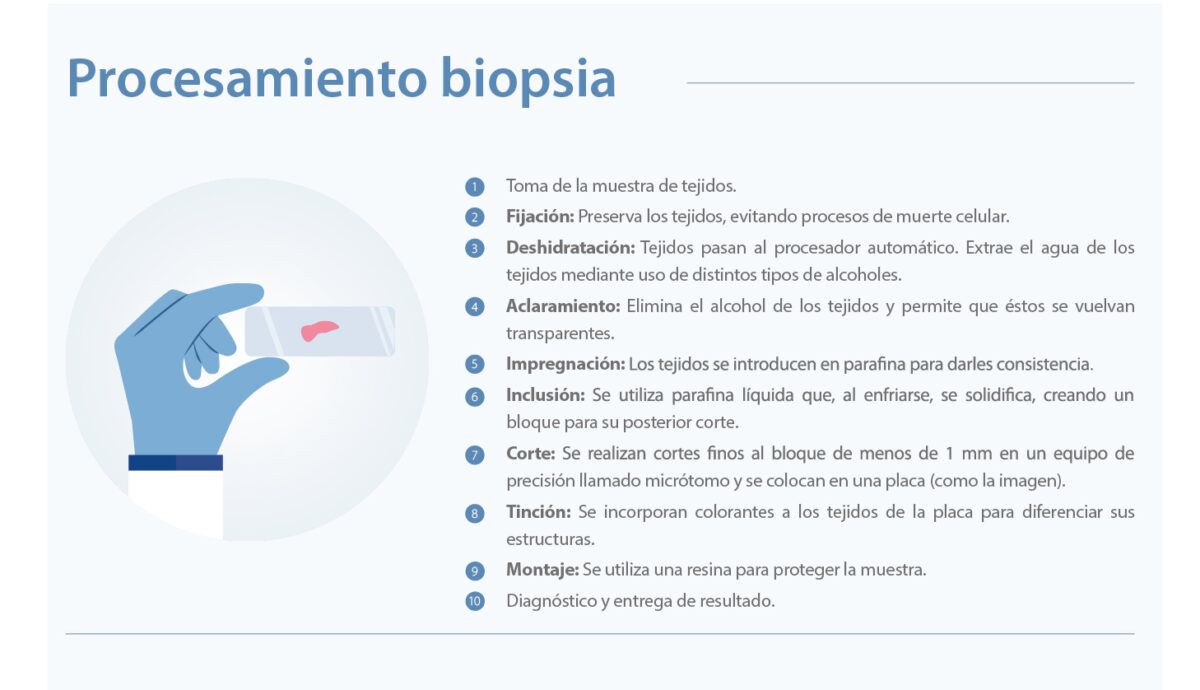 ¿Qué son y cómo se procesan las biopsias? - Fundación Arturo López Pérez