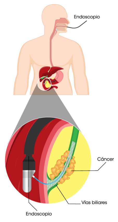 ¿Cuánto demora una CPRE?