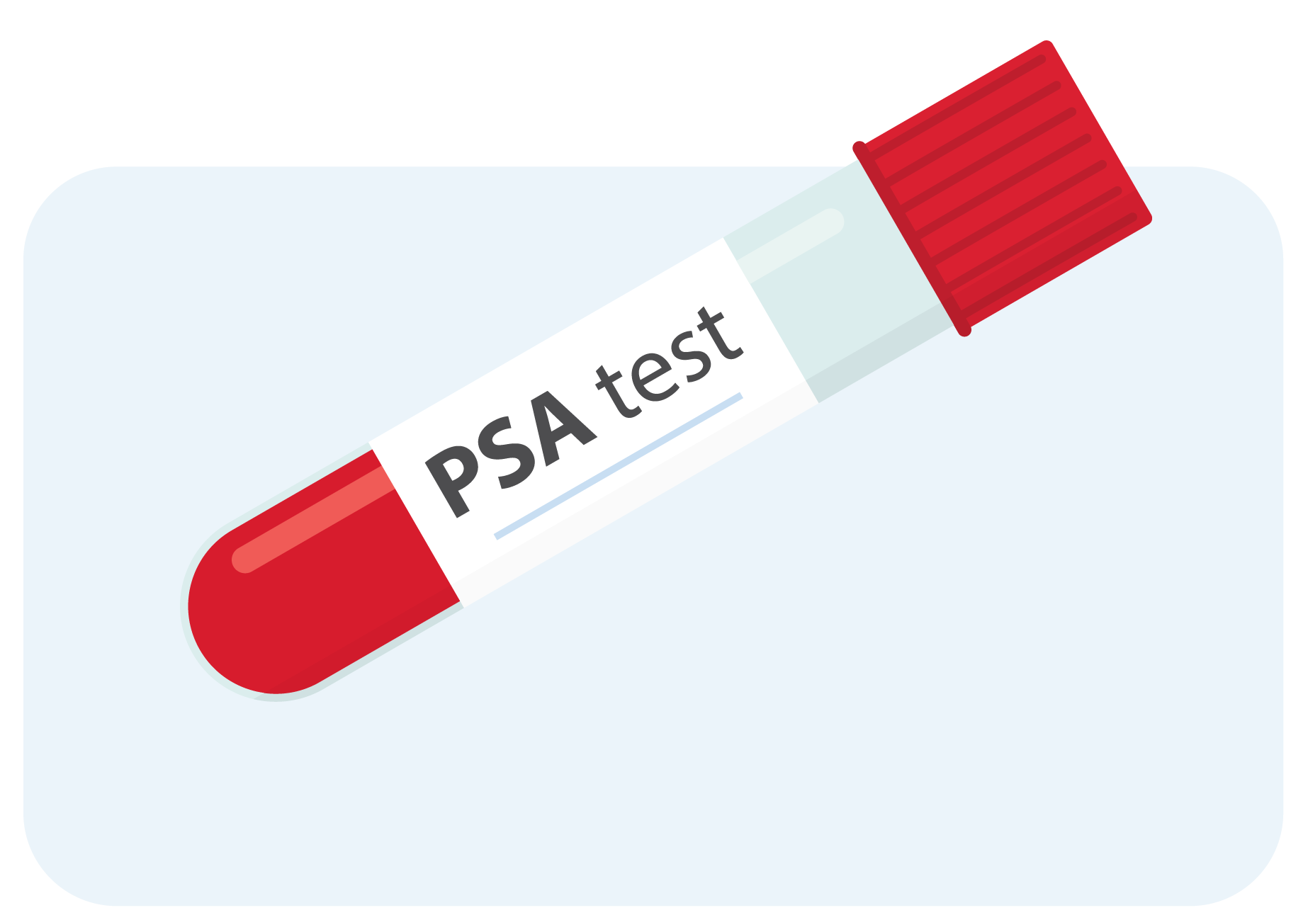 Diagnóstico Cáncer de Próstata - Fundación Arturo López Pérez